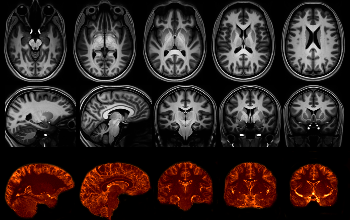 MP2RAGE T1-weighted average 7T model – mri.sbollmann.net
